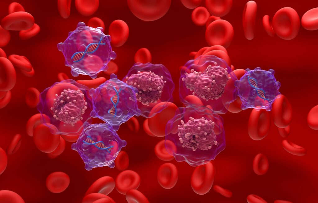 Hyperammonemia due to Organic Acidemias - Bioars Therapeutics